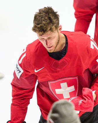 Enzo Corvi Nr. 71 of Switzerland (M) injury after check by Andrew Peeke ...