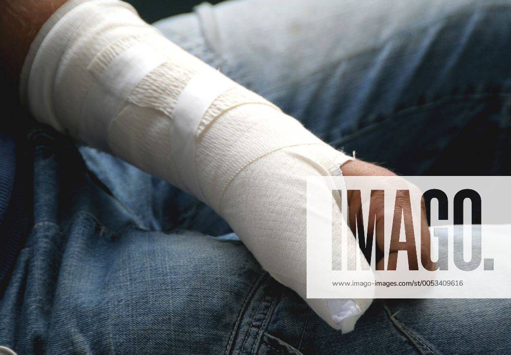 Hand in Gips arm in plaster