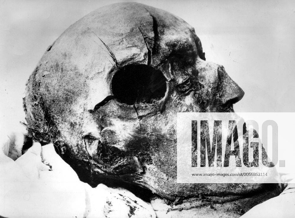 The skull of King Charles XII of Sweden, killed by a cannon shot at the ...