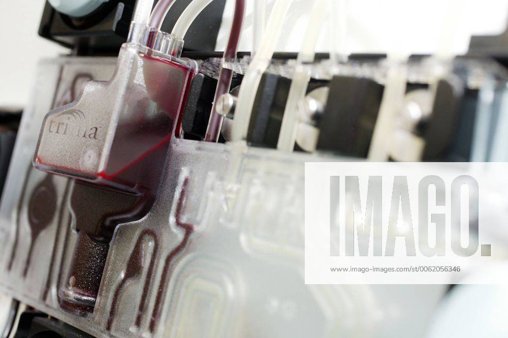 The Trima Accel automated blood collection system helps optimize blood ...