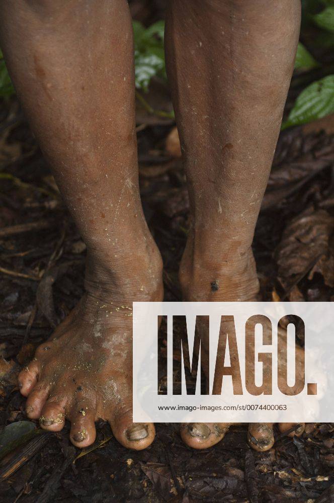 Huaorani Indian with splayed feet. Several of the Huaorani have these ...