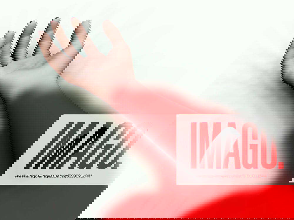 Bloody Arm A bloody decapitated arm for Halloween and medical