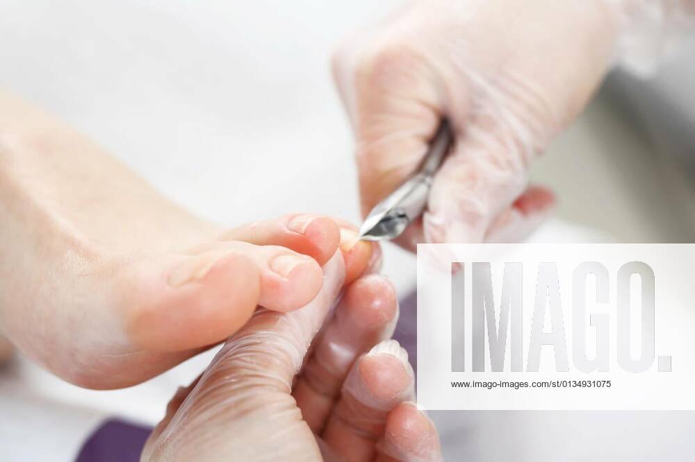 Pedicure in the beauty salon. pedicure stages. podology,cutting skins ...