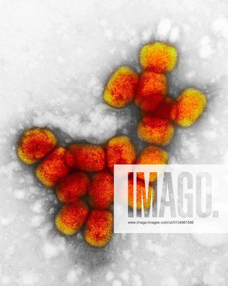 TEM of smallpox virus