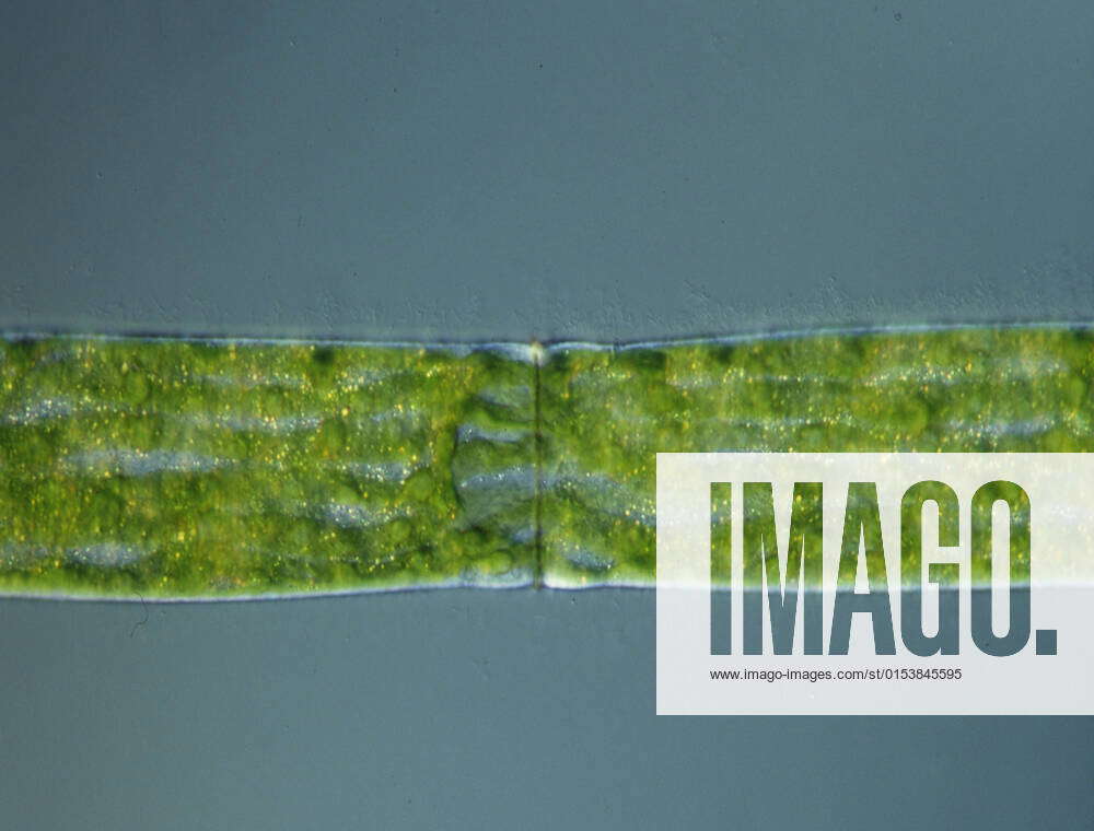 Green algae at high magnification under the microscope, model released ...