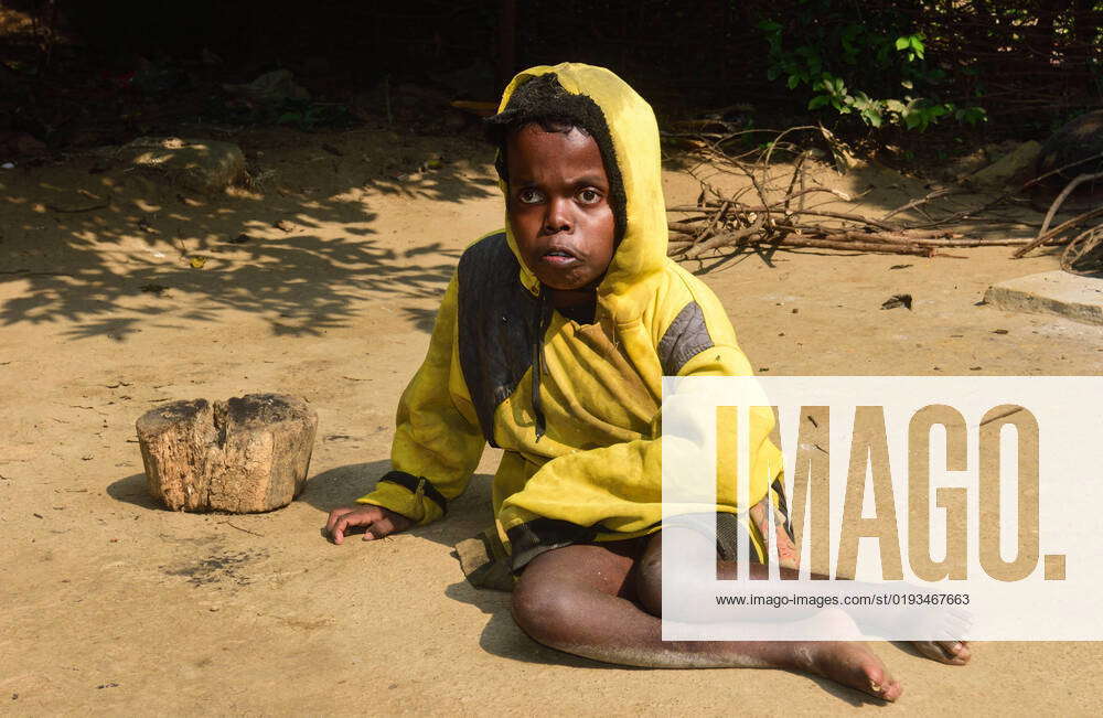 Jadugoda, Jharkhand, India: Hachai Baske age 15 years old in Jadugoda ...