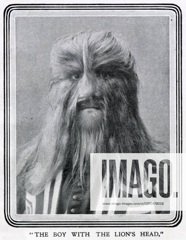 Lionel The Lion Faced Man