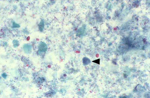 Entamoeba hartmanni This photomicrograph of a trichrome-stained ...