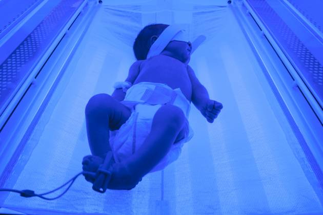 Newborn phototherapy Infants wearing eye masks in phototherapy tunnel ...