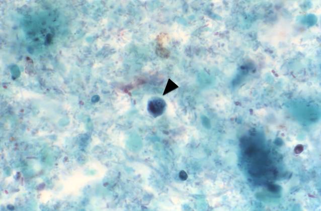 Entamoeba hartmanni This photomicrograph of a trichrome-stained ...