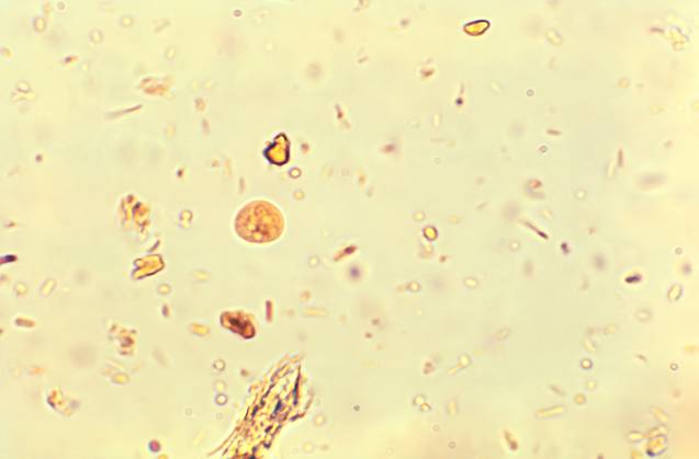 Entamoeba hartmanni This photomicrograph of a trichrome-stained ...