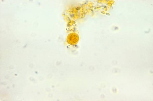 Entamoeba hartmanni This photomicrograph of a trichrome-stained ...