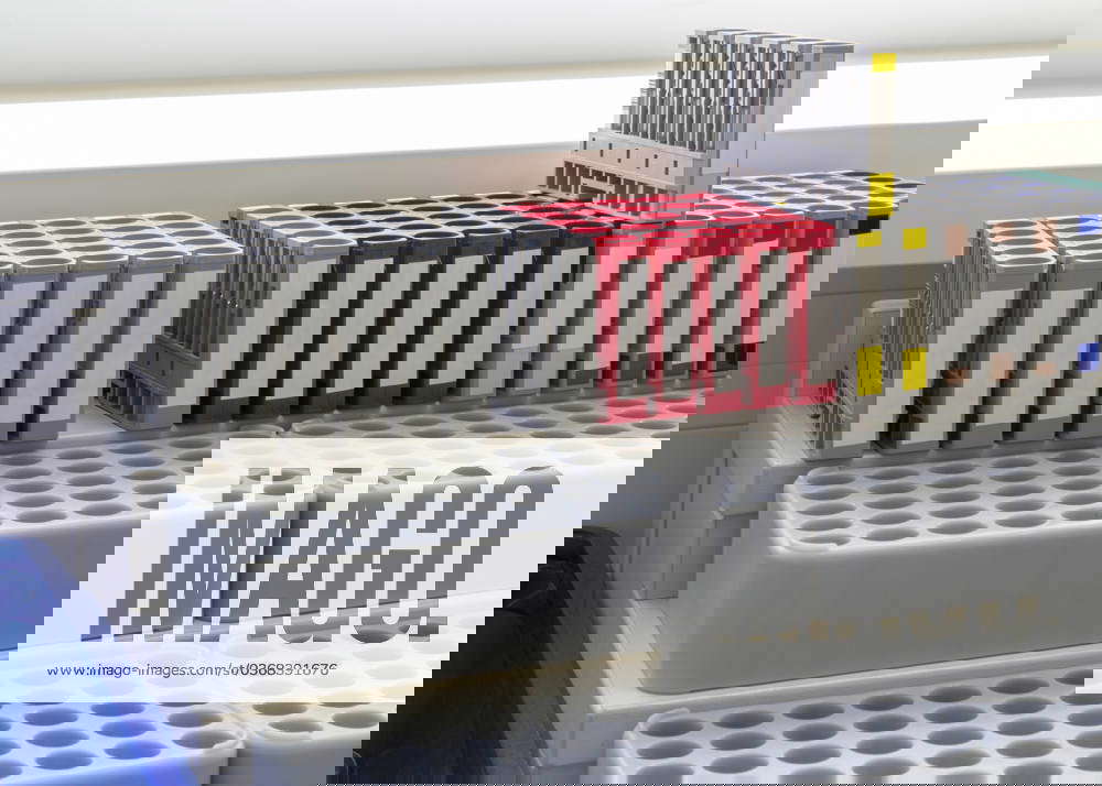 Medical sample racks closeup shot of medical sample racks